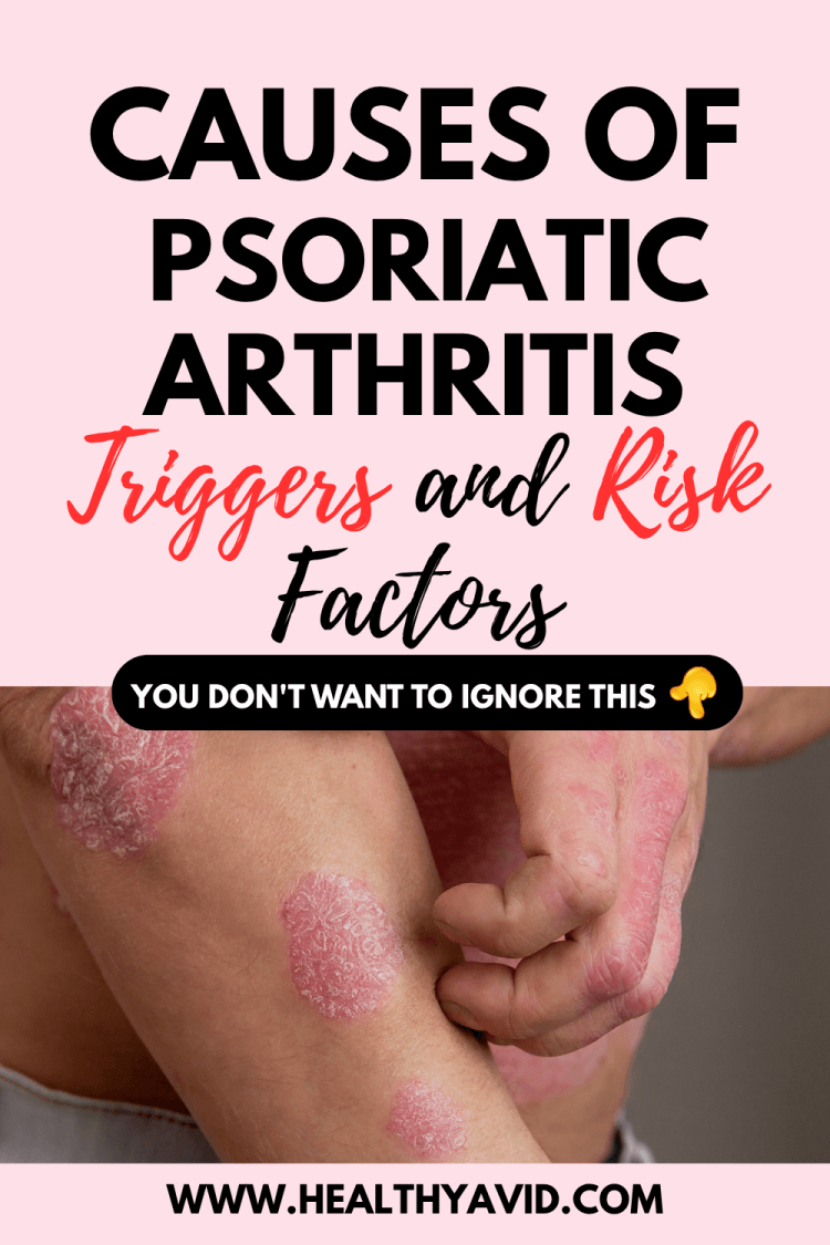Causes of Psoriatic Arthritis: Triggers and Risk Factors - Healthy Avid