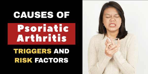 Causes of Psoriatic Arthritis: Triggers and Risk Factors - Healthy Avid